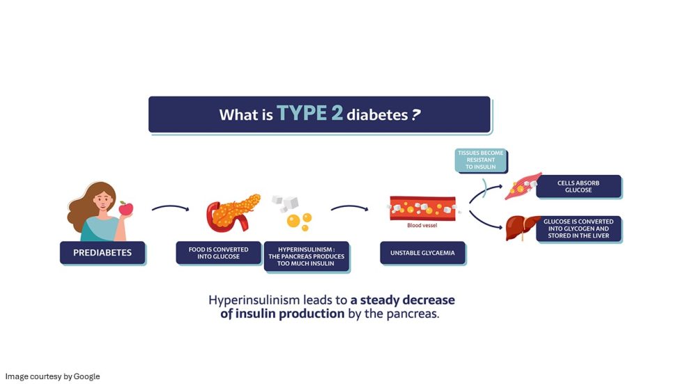 An Overview of Type 2 Diabetes | PremiumRxdrugs- Online Pharmacy