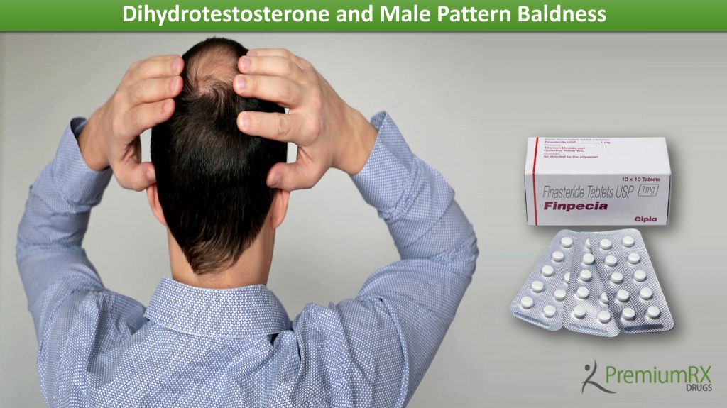 Dihydrotestosterone and Male Pattern Baldness | PremiumRxdrugs- Online ...