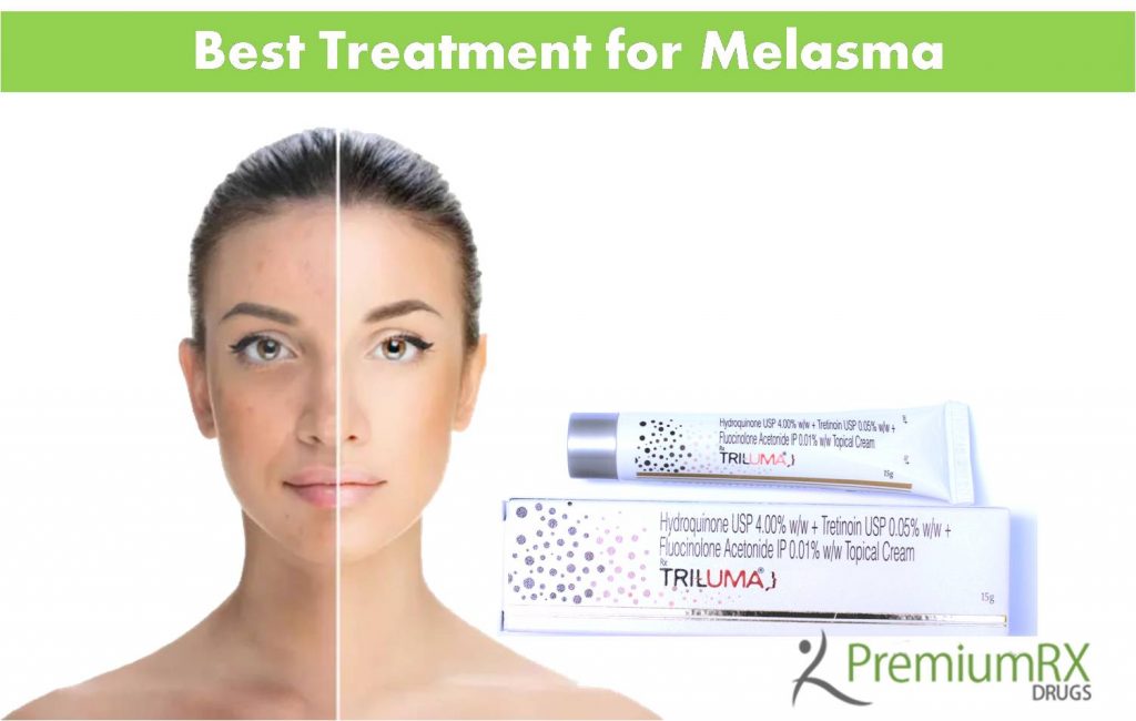 Best Treatment for Melasma | PremiumRxdrugs- Online Pharmacy