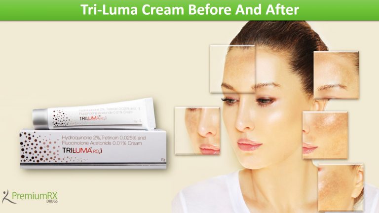 Tri-Luma Cream Before And After | PremiumRxdrugs- Online Pharmacy